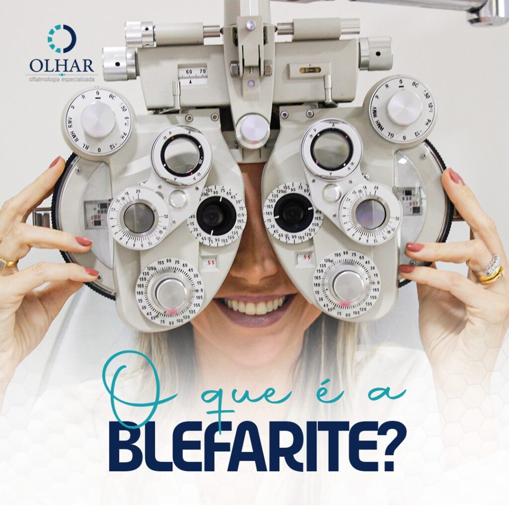 O que é Blefarite? – Olhar Oftalmologia Especializada